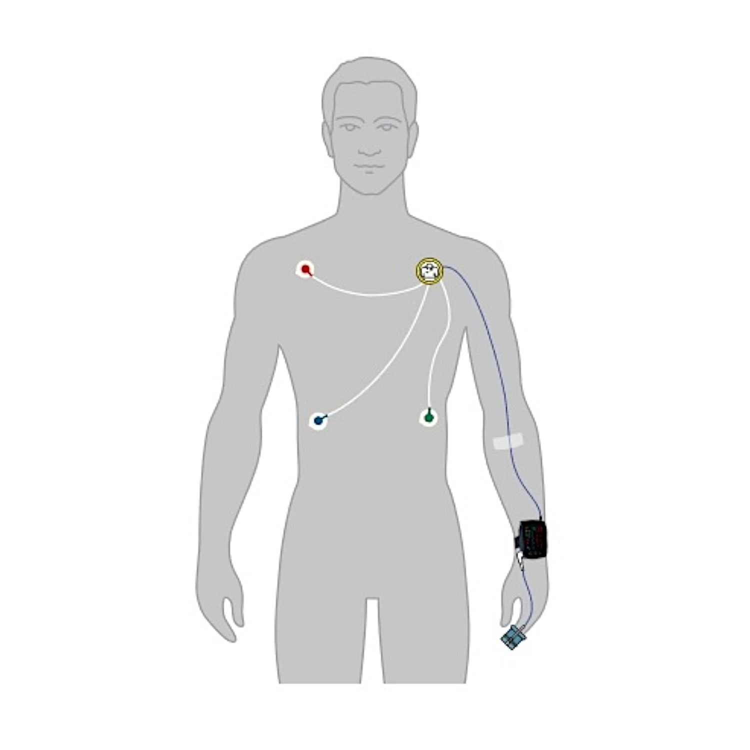 Somnotouch NIBP Continuous non-invasive Blood pressure 24 hours ...